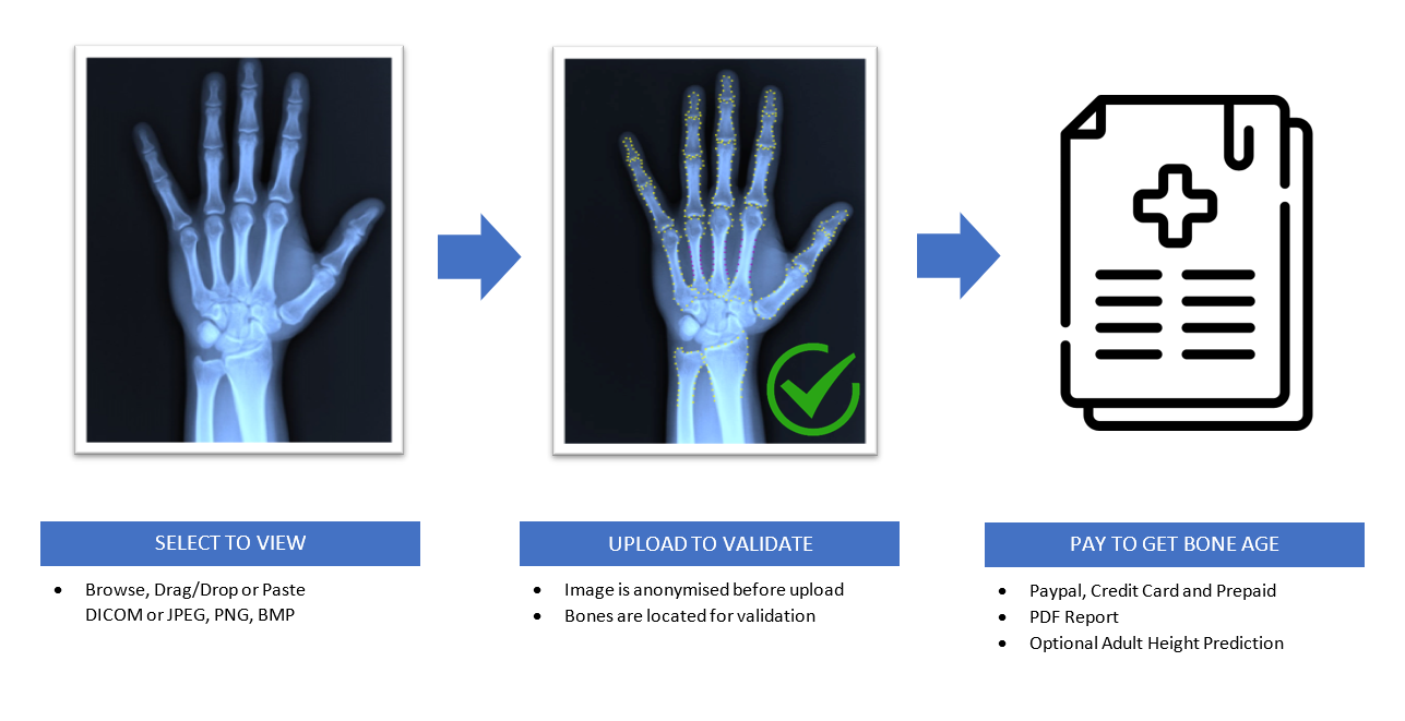BoneXpert Online: Automated bone age in your browser - BoneXpert