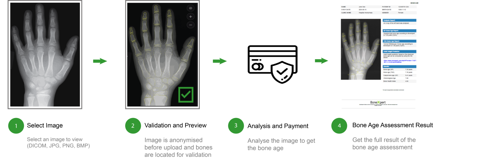 BoneXpert Online – Automated bone age analysis in your browser - BoneXpert