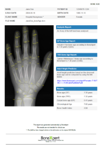 BoneXpert Online – Automated bone age analysis in your browser - BoneXpert