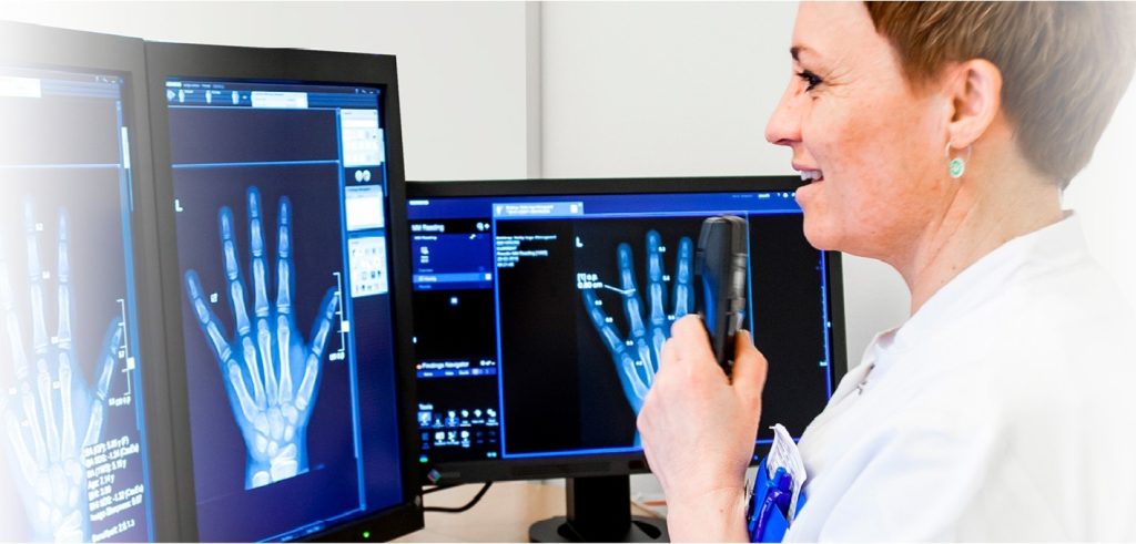 BoneXpert Server - the solution for hospitals - BoneXpert